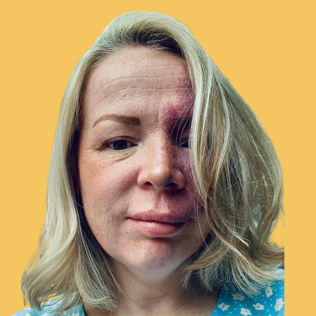 Hatchford Brook Family Hub - Elmdon | Your Voice Solihull