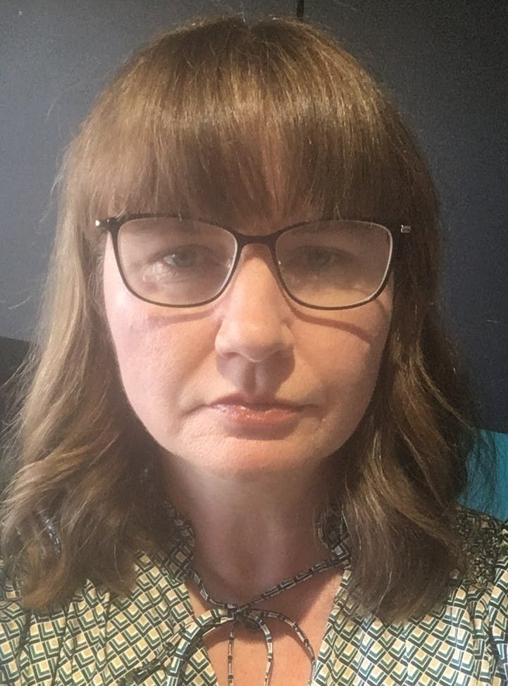 Holmewood – The proposed ATN will be in South Holme Wood | Let's Talk ...